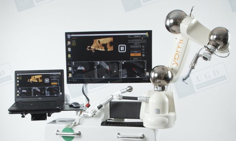 Neocis Yomi Dental Implant Robotic Guidance System - Universal Global ...